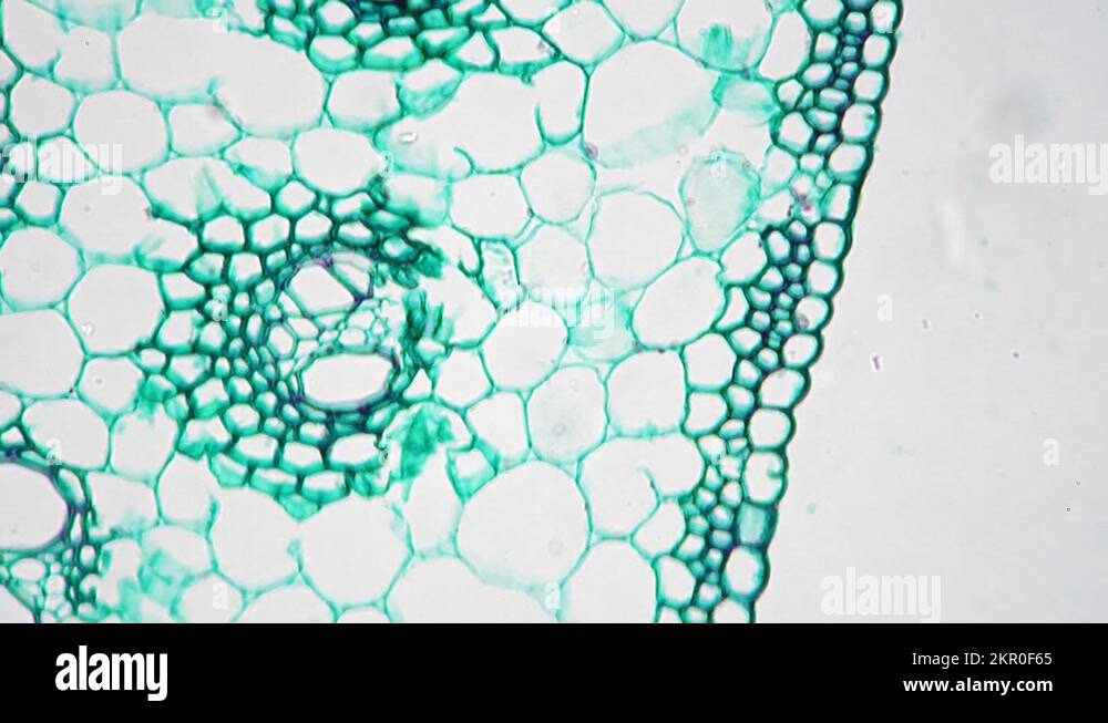 Monocotyledon Stem in transversal section cut under the microscope 200x ...