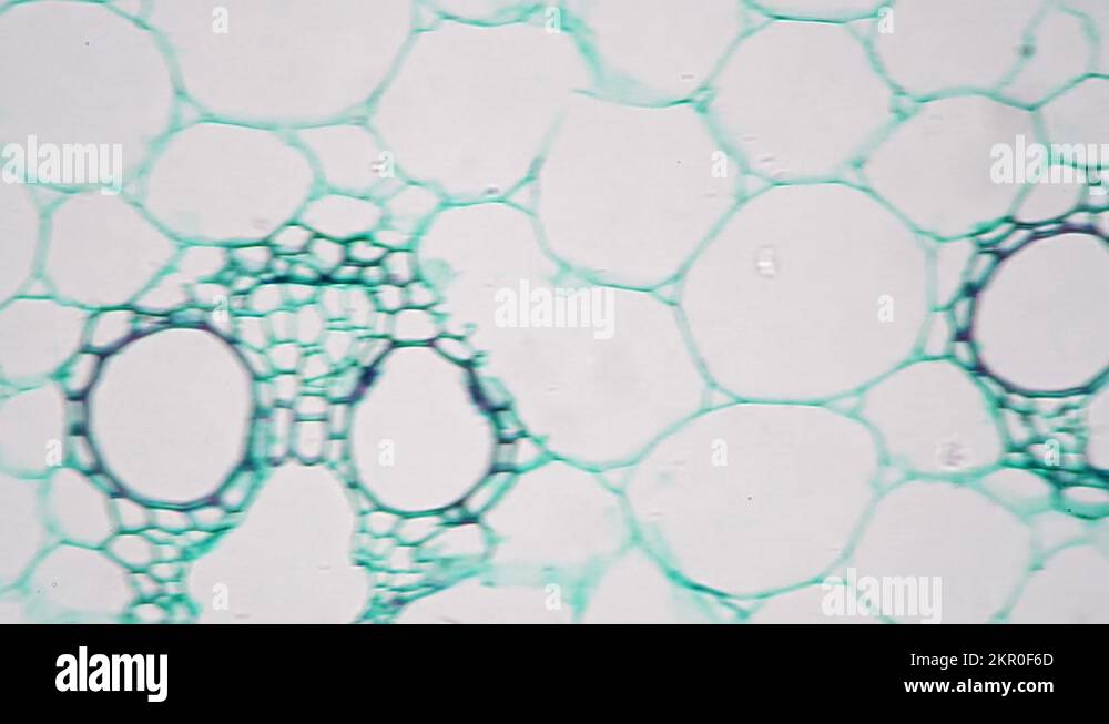 Monocotyledon Stem in transversal section cut under the microscope 400x ... Monocotyledon Stem in transversal section cut under the microscope 400x ...