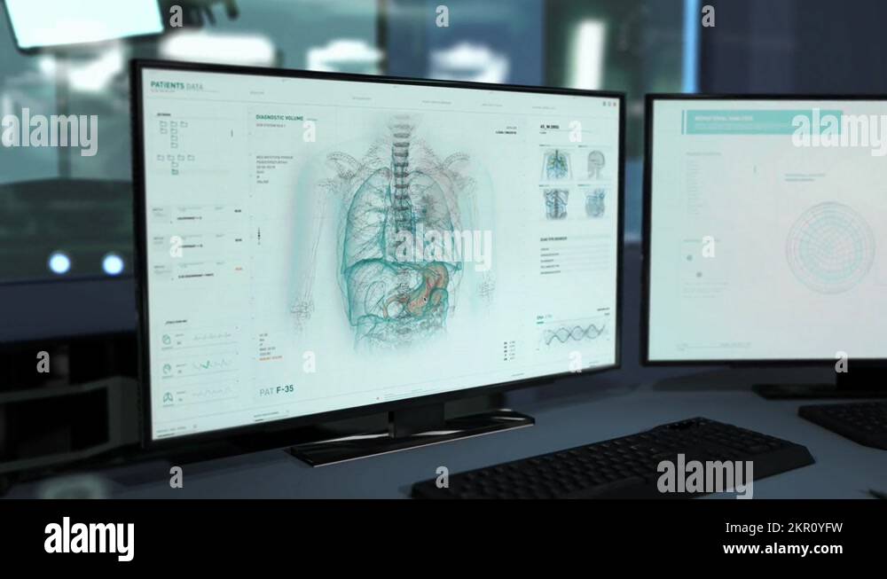 Diagnosing Cardiac Ischemia Using Anatomical Scanner Interface To ...