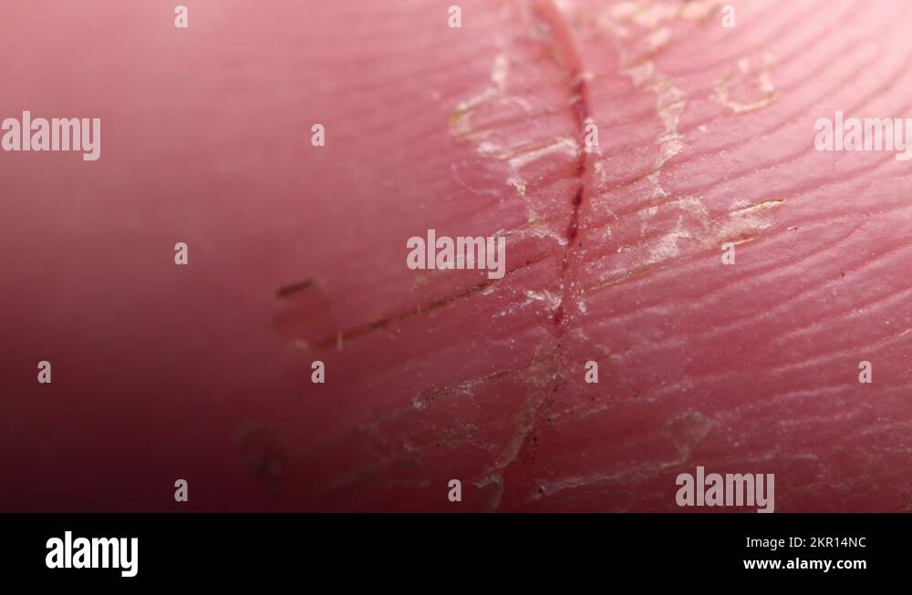 Deep scar Stock Videos & Footage - HD and 4K Video Clips - Alamy