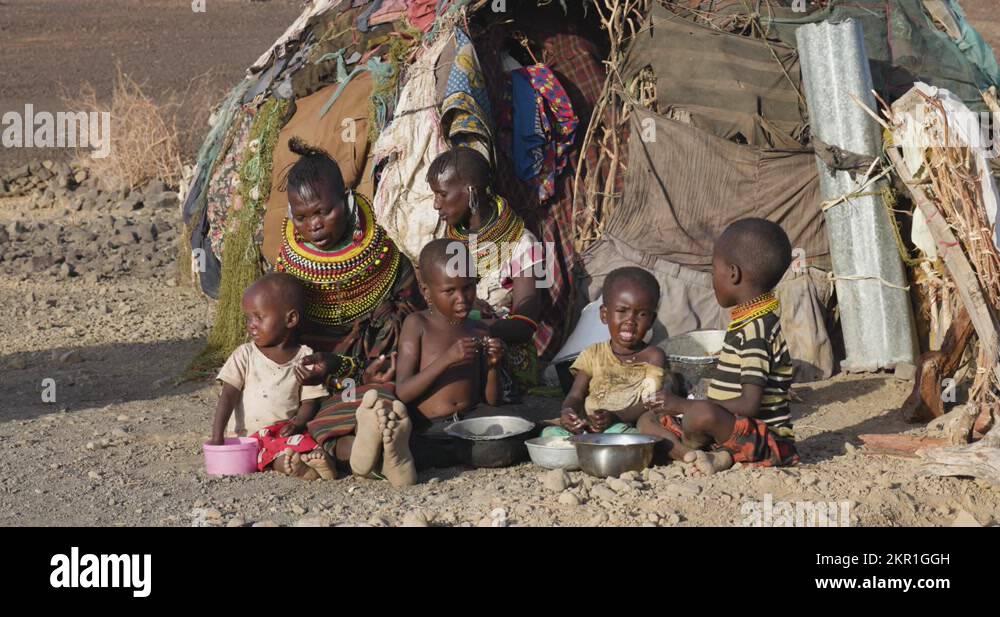 Malnourished children due to extreme poverty, drought and climate ...