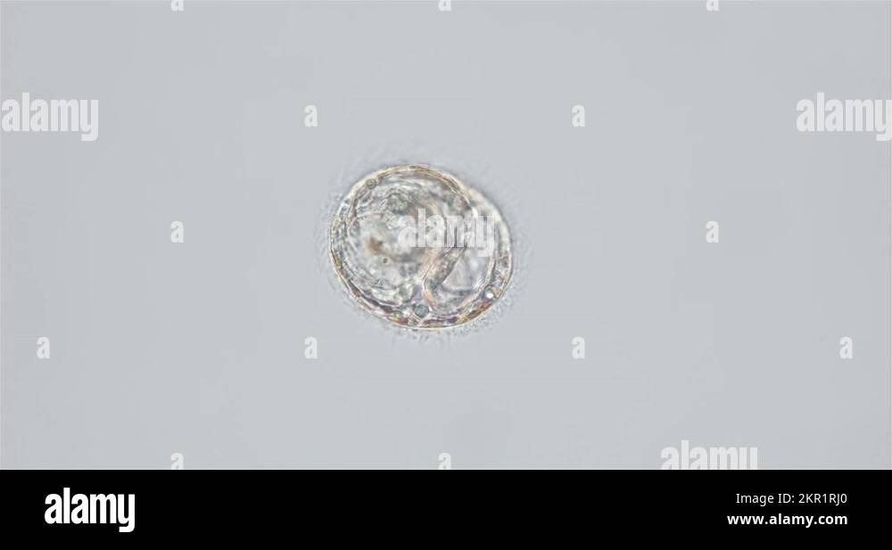 Worm larva Ophelia limacina at trochophora stage under microscope ...