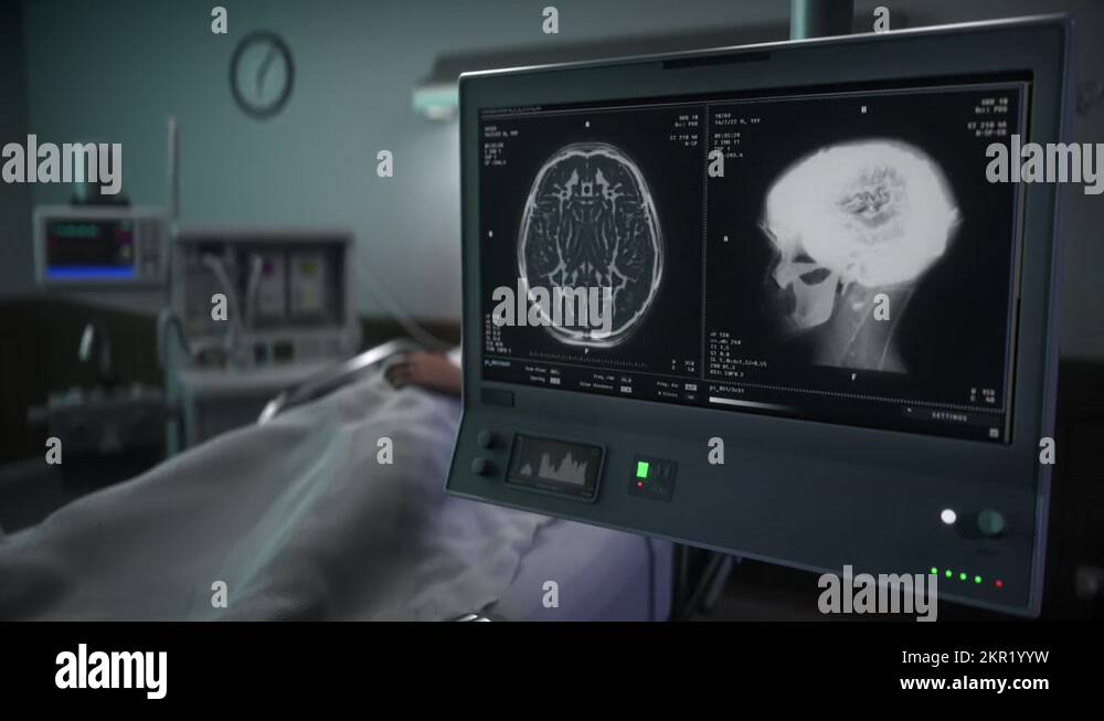 Patient Head Examination By Modern X-ray Scanner For Brain Cancer ...