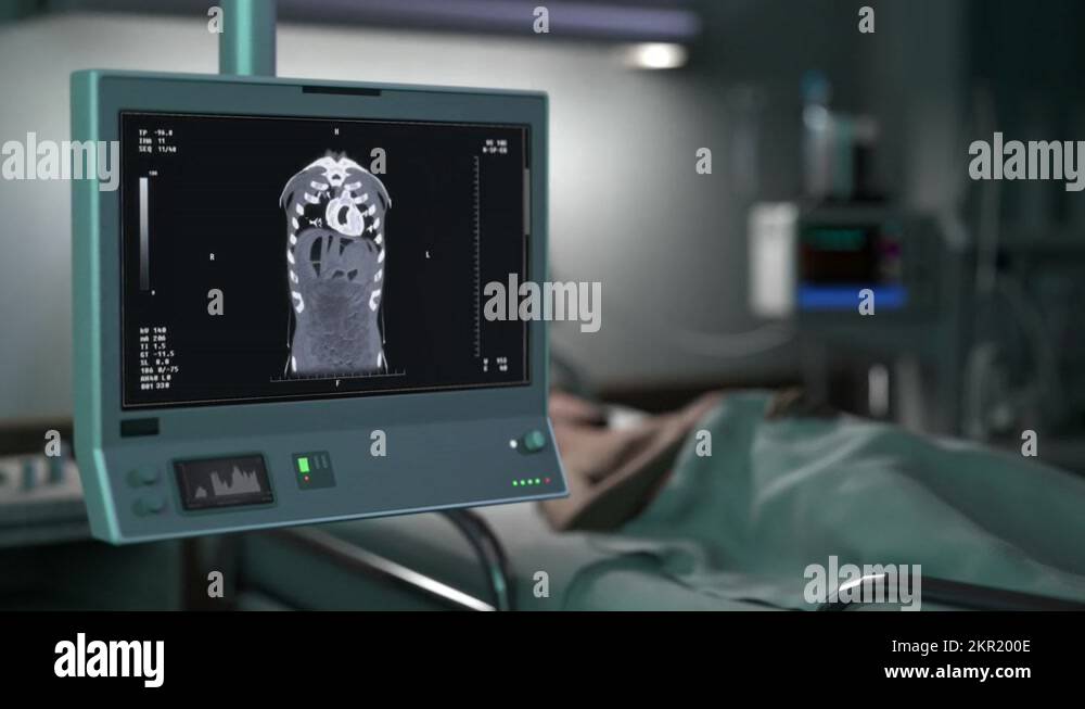 Chest x ray investigation Stock Videos & Footage - HD and 4K Video ...