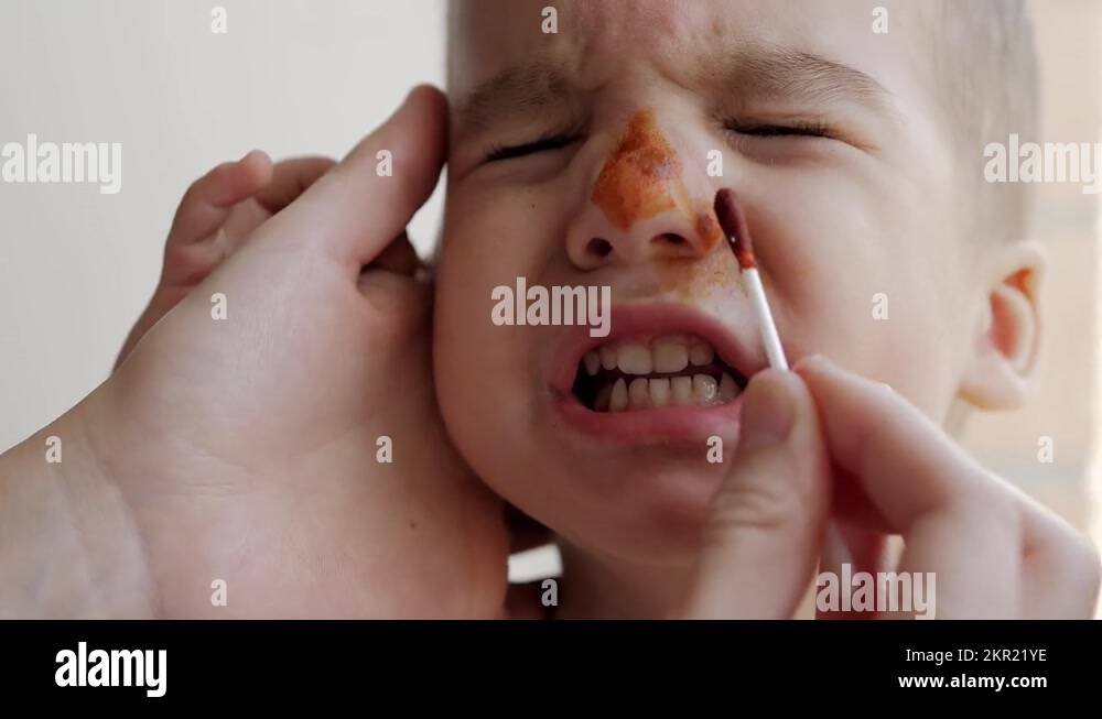 A caring mother applying antiseptic cream to a scratch and a bump on ...