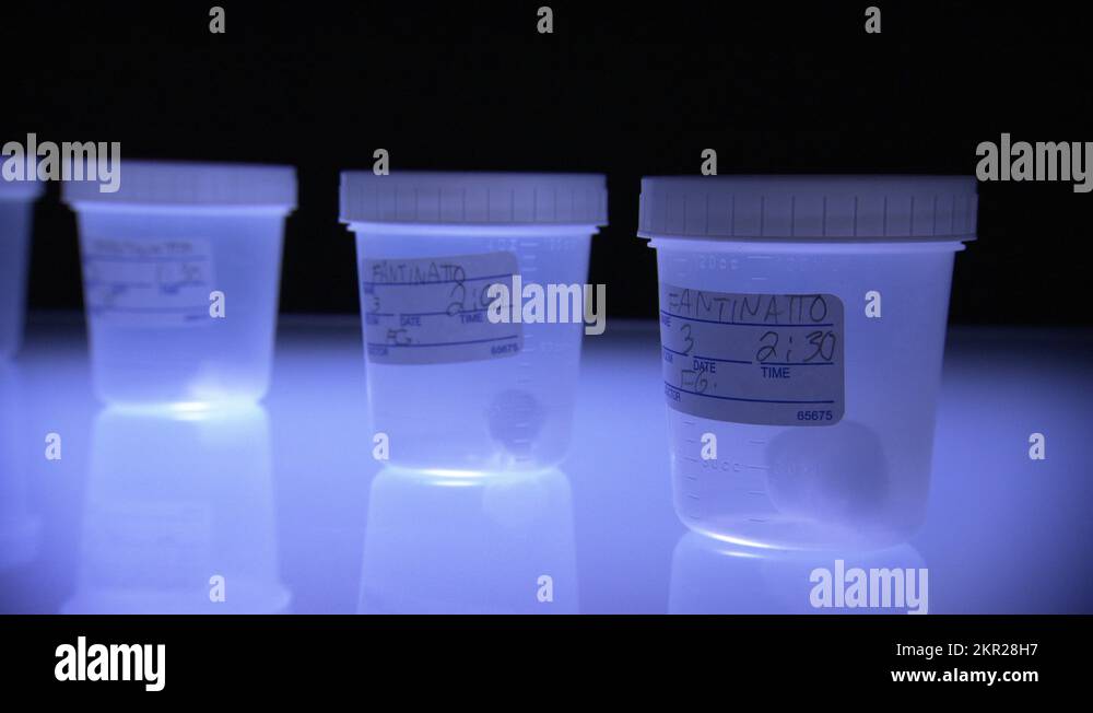 Specimen containers Stock Videos & Footage - HD and 4K Video Clips - Alamy