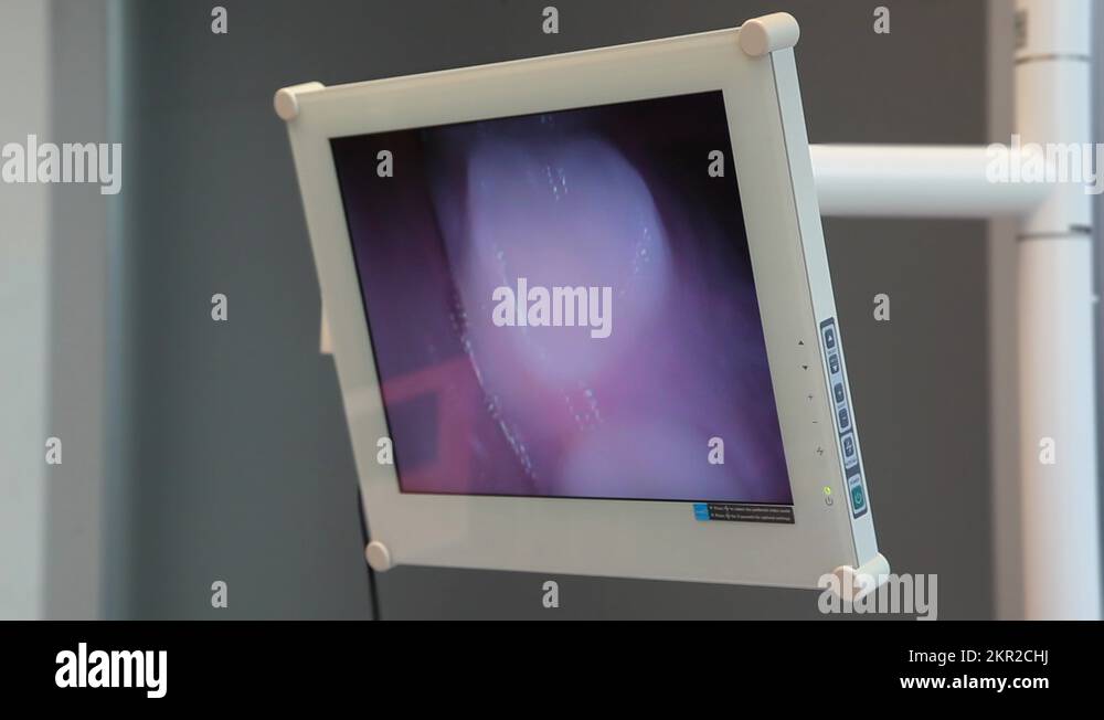 Dental clinic monitor tooth Stock Video Footage - Alamy