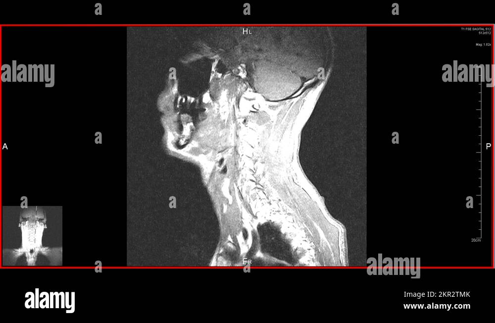 Mrt scan Stock Videos & Footage - HD and 4K Video Clips - Alamy