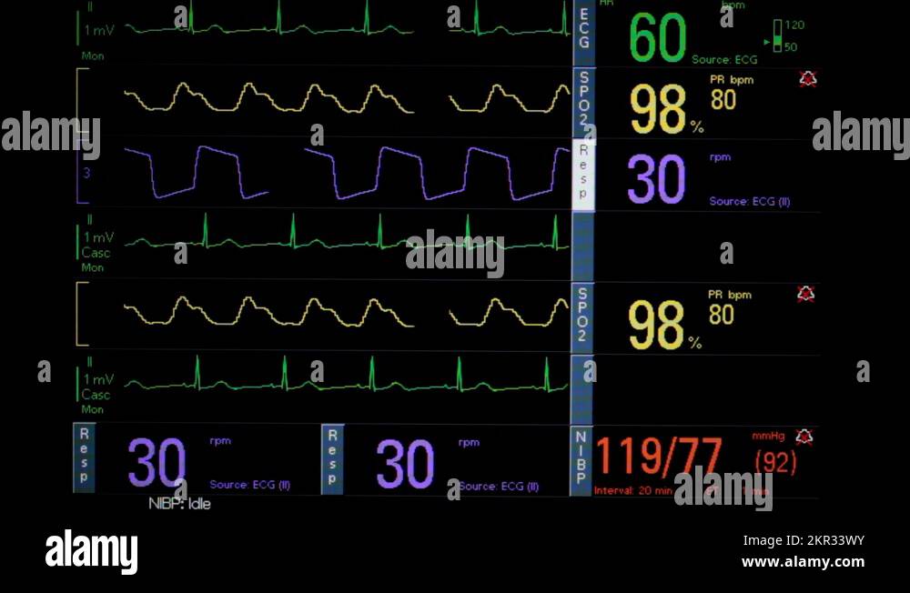 Patient vital signs Stock Videos & Footage - HD and 4K Video Clips - Alamy