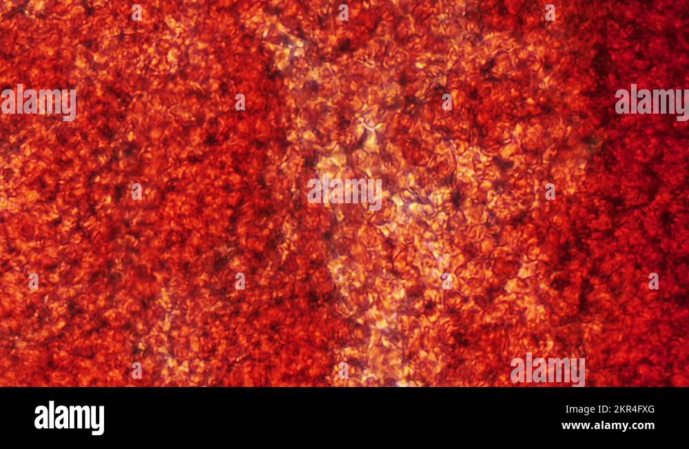 Blood capillaries Stock Videos & Footage - HD and 4K Video Clips - Alamy