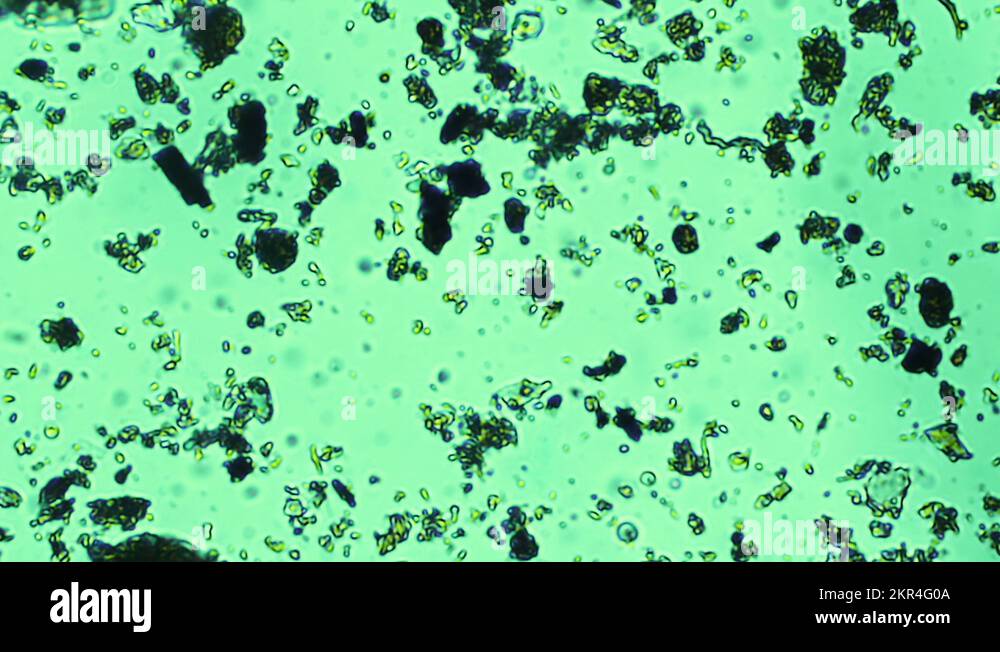 Soil bacteria microscope Stock Videos & Footage - HD and 4K Video Clips ...