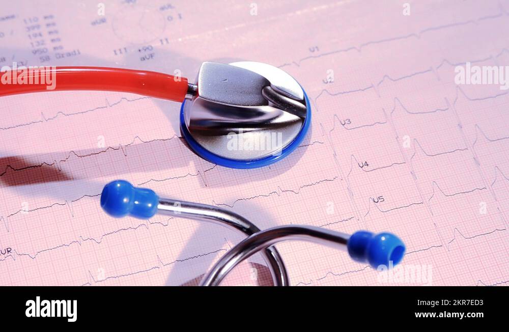 Medical stethoscope electrocardiogram graph ekg Stock Videos & Footage ...