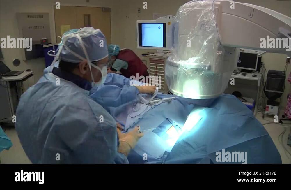 Electrophysiology procedure Stock Videos & Footage - HD and 4K Video ...