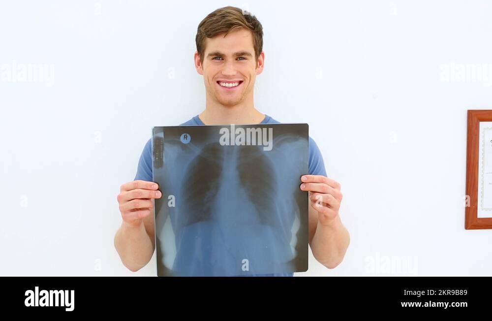 Smiling patient showing his positive xray Stock Video Footage - Alamy