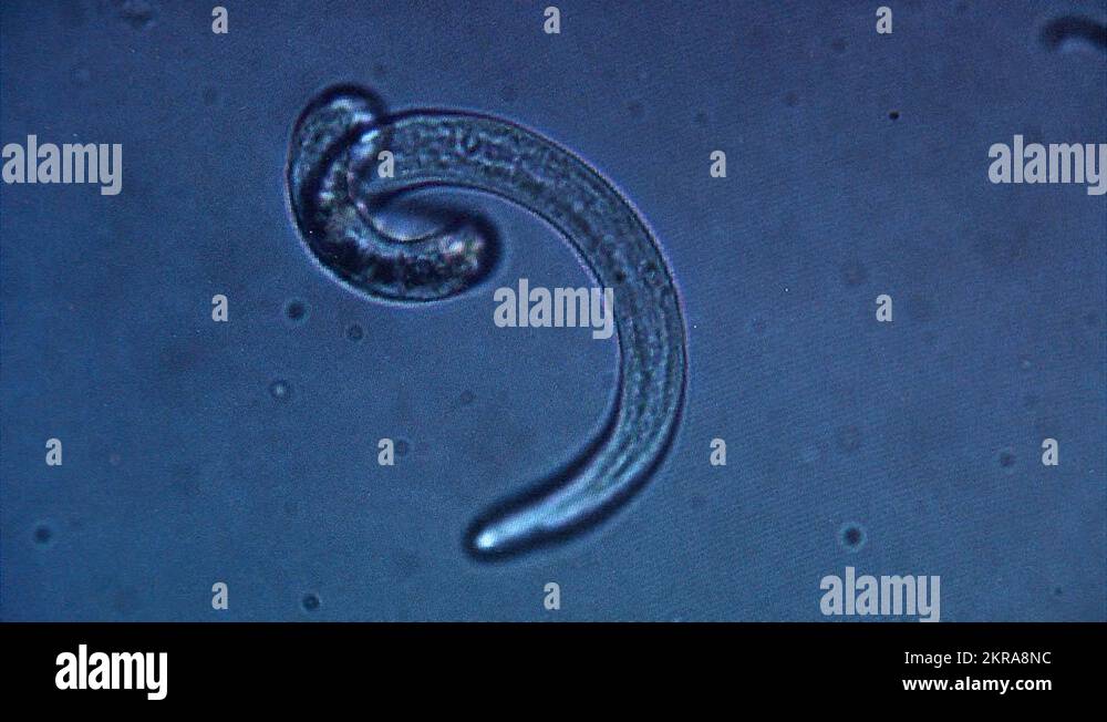 Pinworm parasite Stock Videos & Footage - HD and 4K Video Clips - Alamy