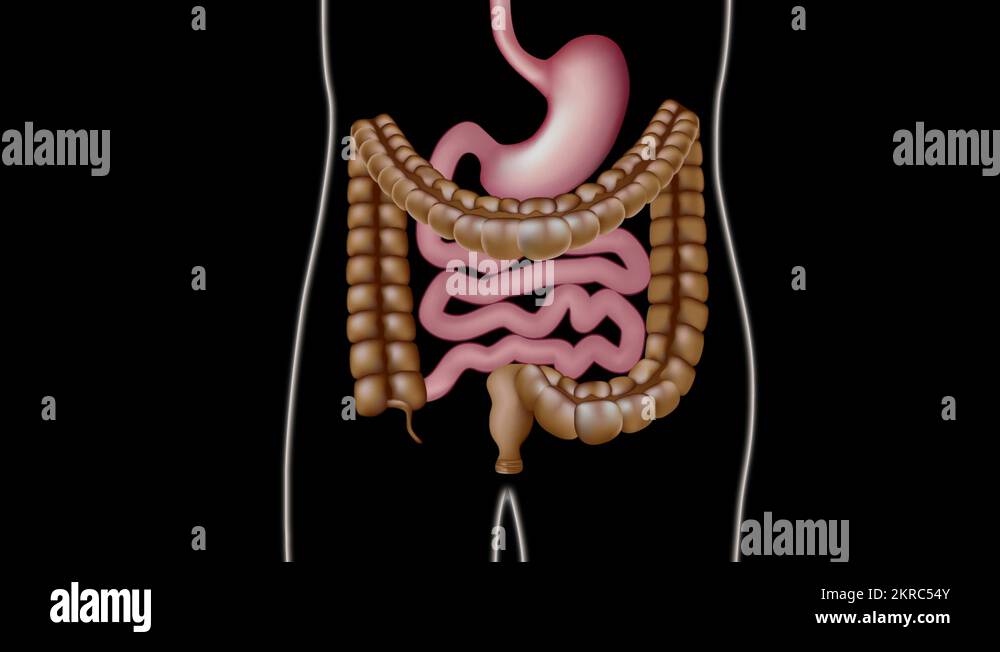 Colonoscopy procedure showing endoscope image Stock Video Footage - Alamy Colonoscopy procedure showing endoscope image Stock Video Footage - Alamy