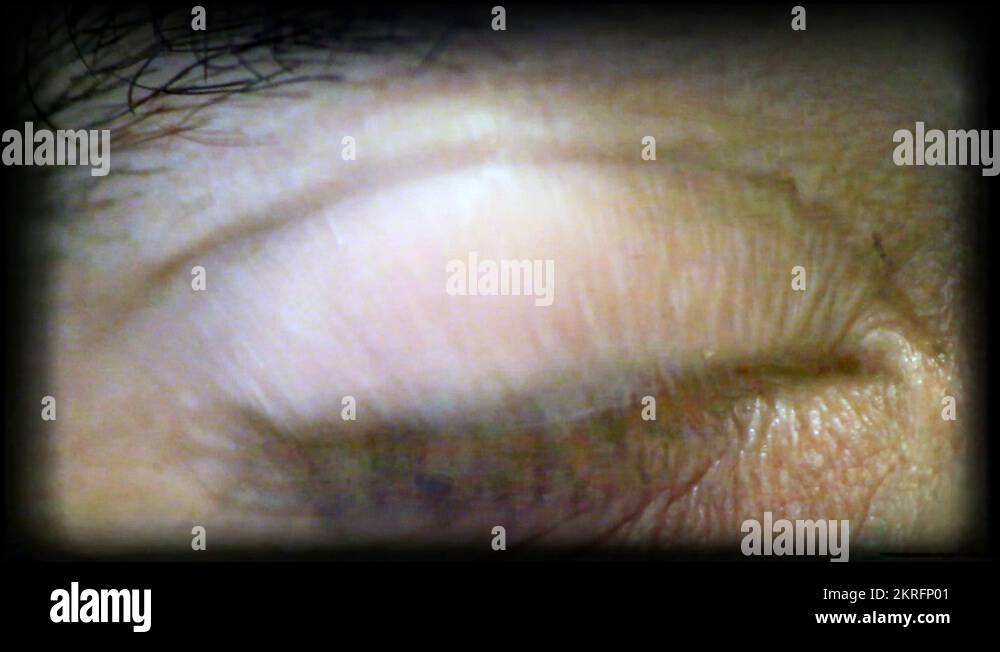 Marco eye Stock Videos & Footage - HD and 4K Video Clips - Alamy