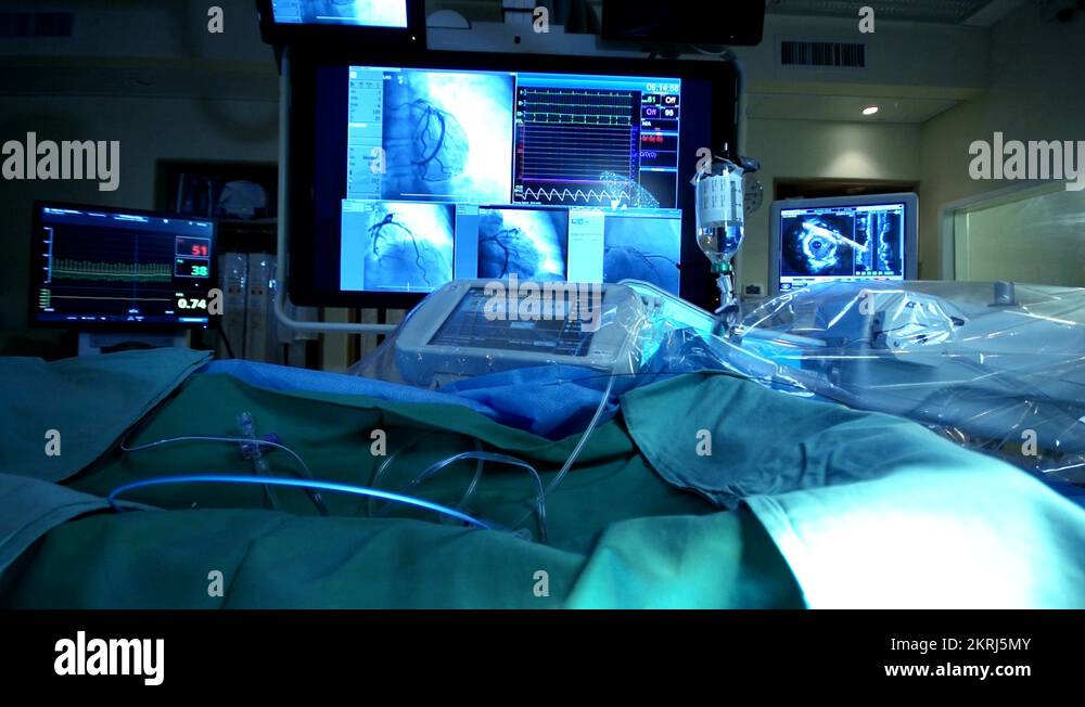 Cardiac catheterization room Stock Videos & Footage - HD and 4K Video ...
