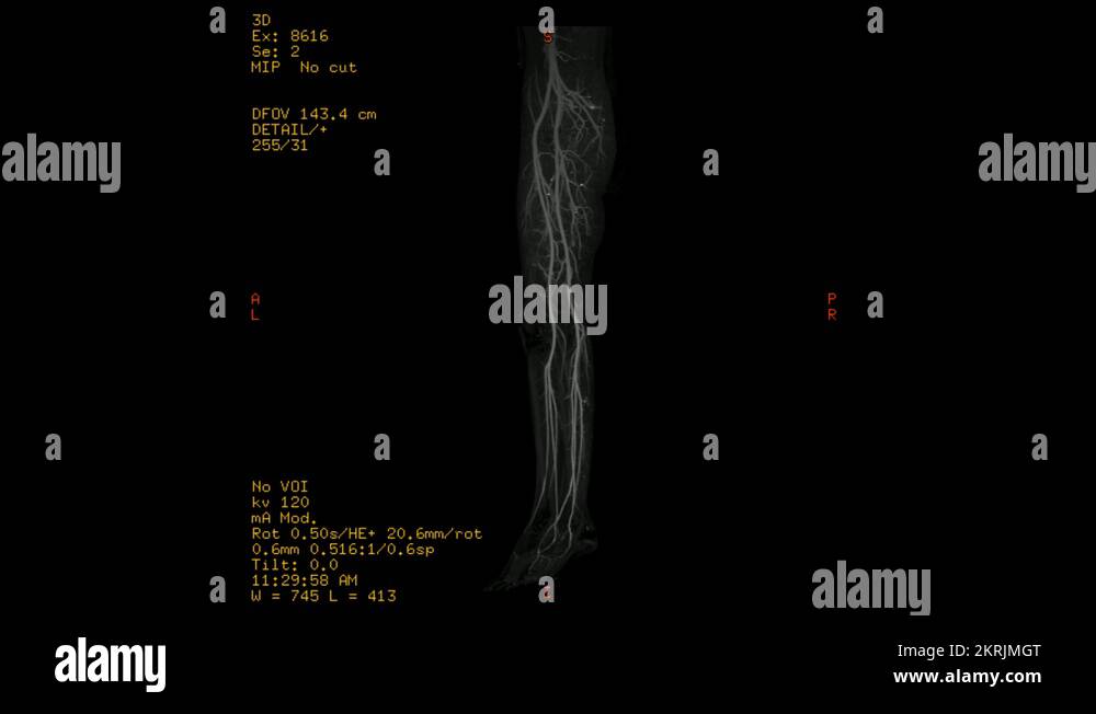 Ct scan leg Stock Videos & Footage - HD and 4K Video Clips - Alamy