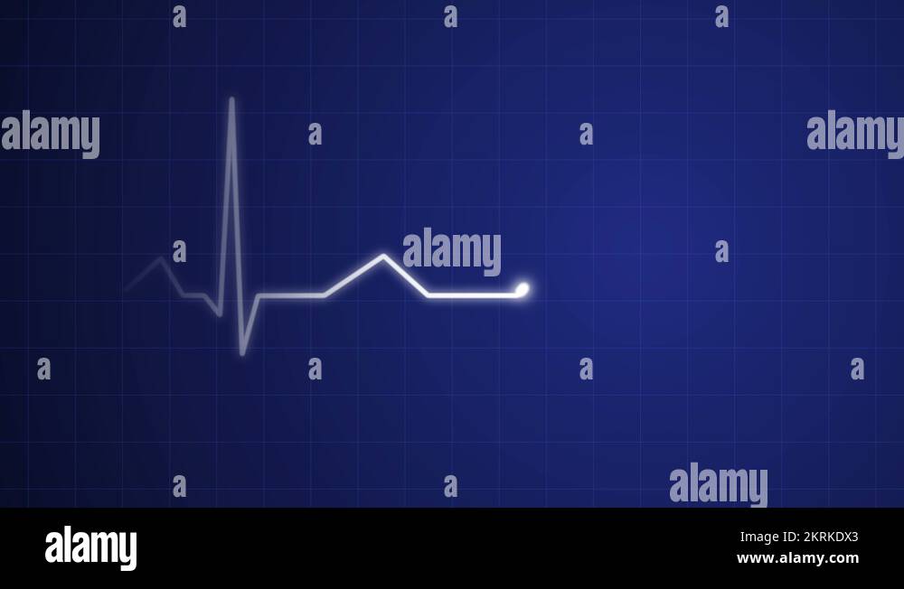 4k an animated heart monitor ekg flatlines, uhd stock video animation ...
