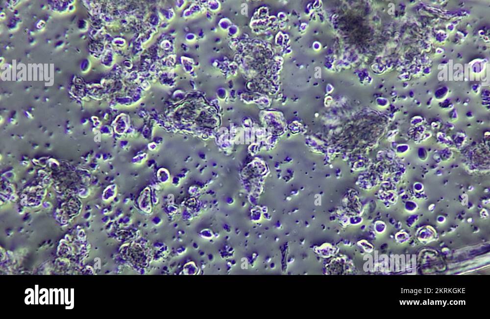 Helicobacter pylori microscope Stock Videos & Footage - HD and 4K Video ...