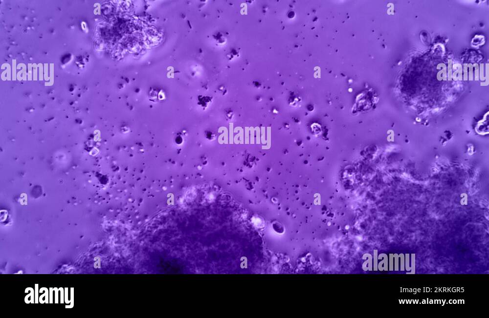 Bacterial plaque Stock Videos & Footage - HD and 4K Video Clips - Alamy