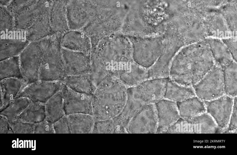 Colorectal cells Stock Videos & Footage - HD and 4K Video Clips - Alamy