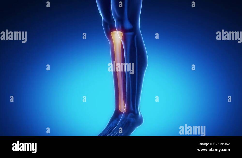 Tibia x ray Stock Videos & Footage - HD and 4K Video Clips - Alamy