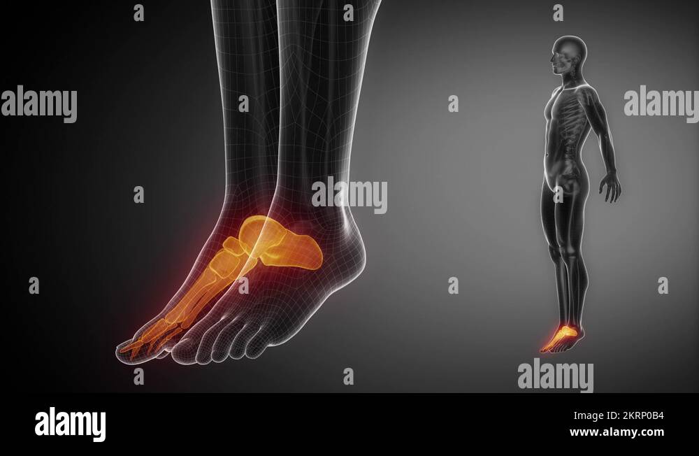 Ankle bone Stock Videos & Footage - HD and 4K Video Clips - Alamy