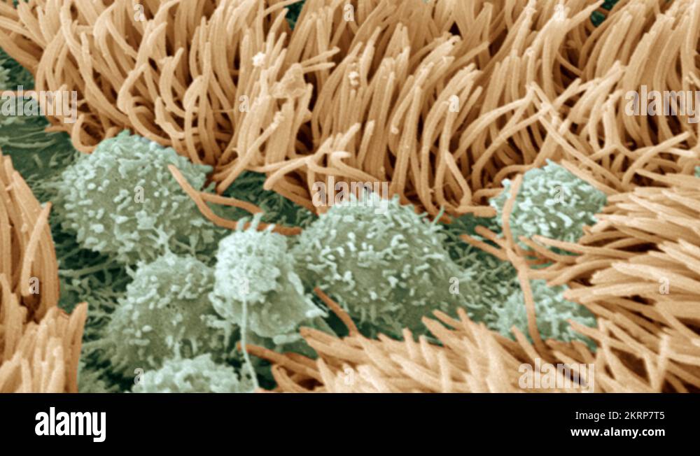 Fallopian tube Stock Videos & Footage - HD and 4K Video Clips - Alamy