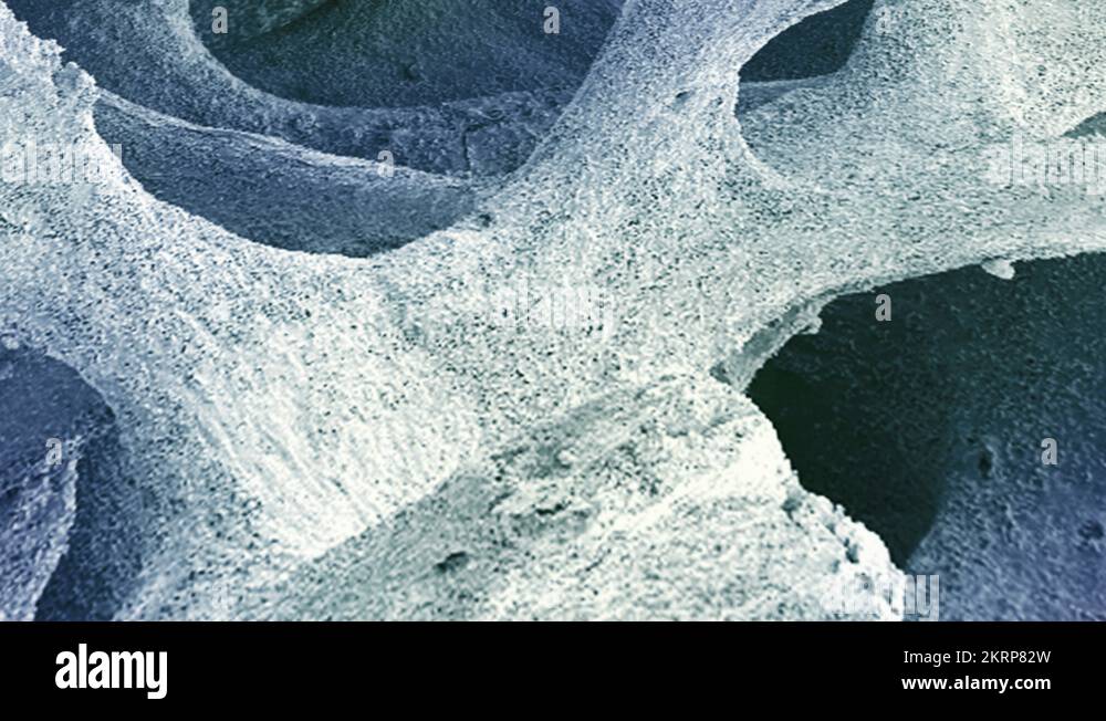 Bone marrow and tissue Stock Videos & Footage - HD and 4K Video Clips ...