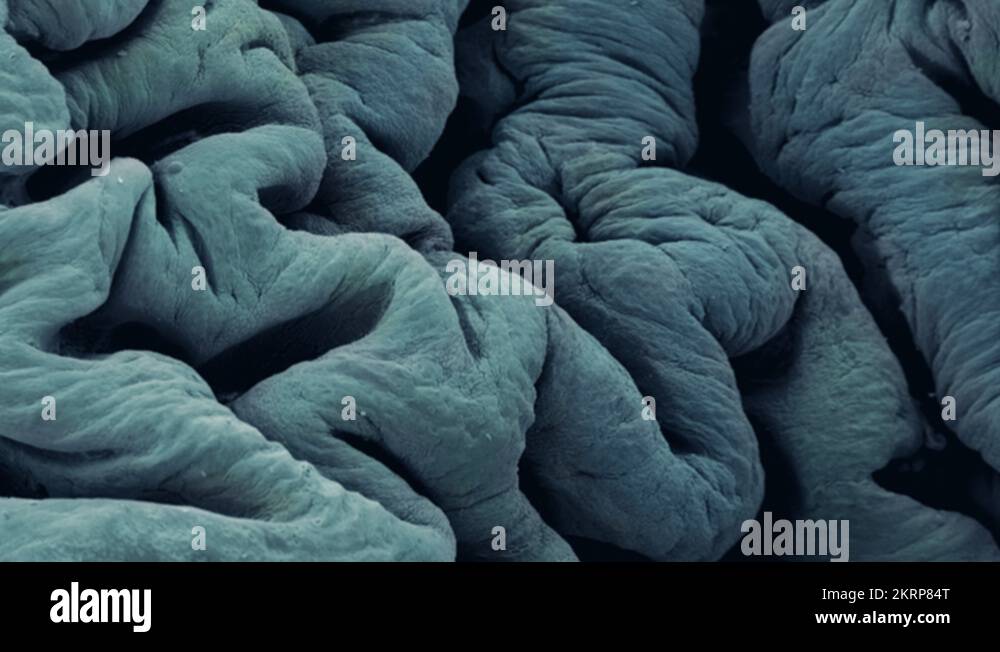 Urinary bladder epithelium, SEM Stock Video Footage - Alamy