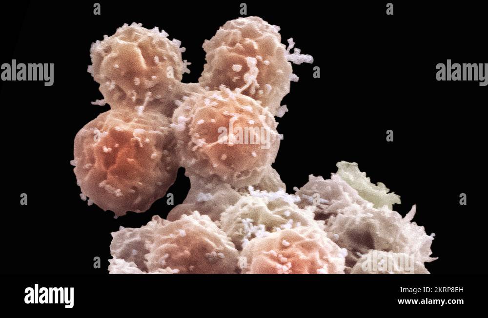 Blood stem Stock Videos & Footage - HD and 4K Video Clips - Alamy