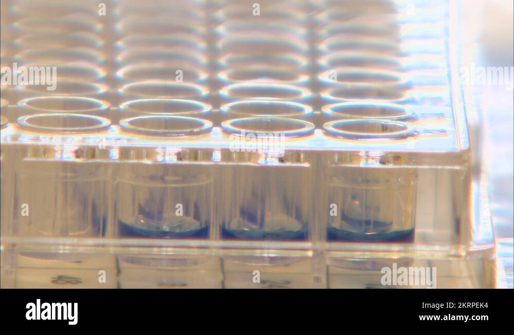 Pathology laboratories Stock Videos & Footage - HD and 4K Video Clips ...