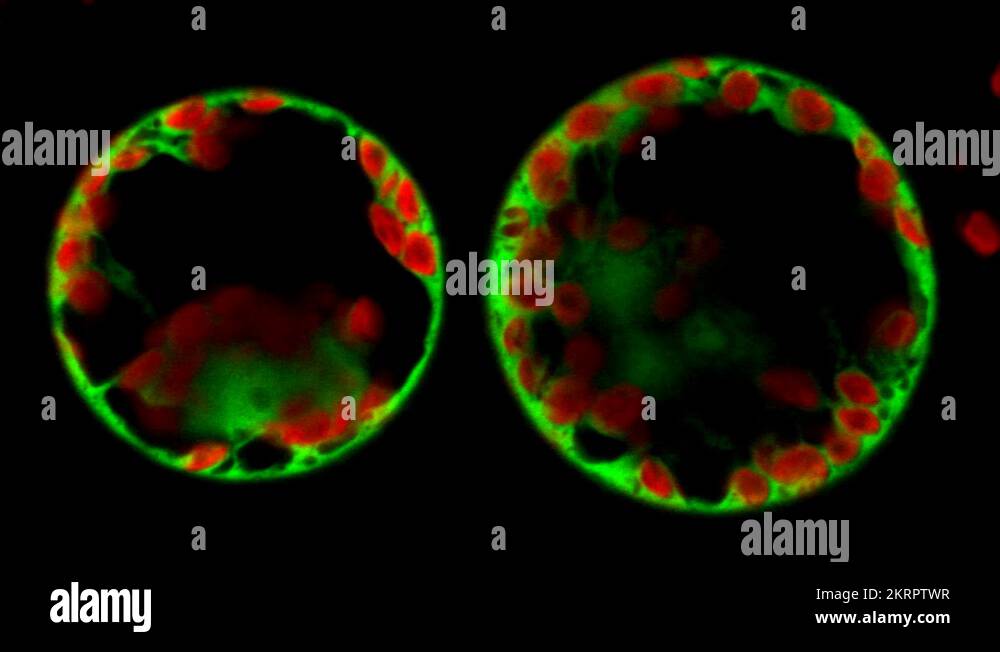 Arabidopsis protoplasts, confocal microscopy Stock Video Footage - Alamy