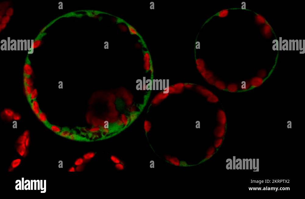 Arabidopsis protoplasts, confocal microscopy Stock Video Footage - Alamy