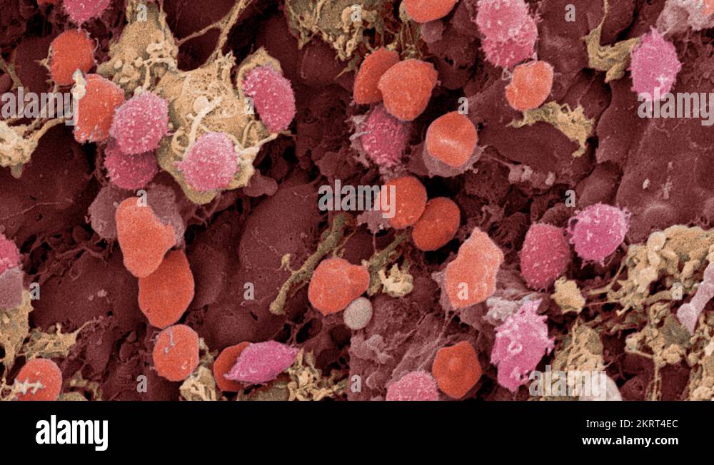 Red blood cell light micrograph Stock Videos & Footage - HD and 4K ...