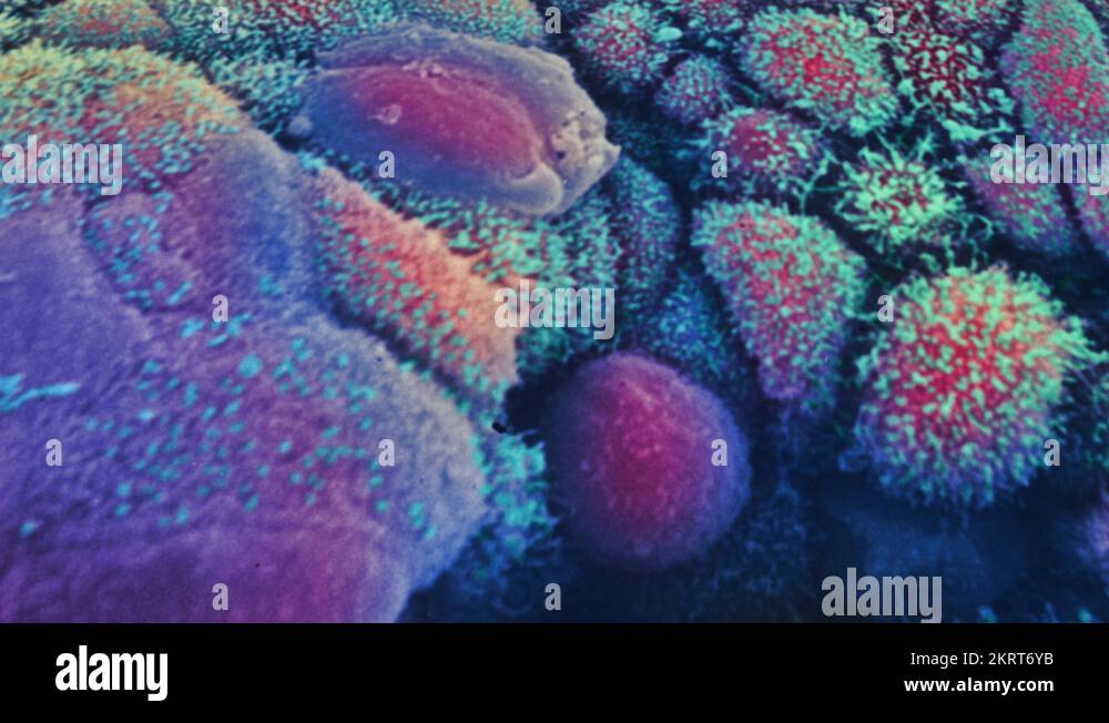 Cancer cells micrograph Stock Videos & Footage - HD and 4K Video Clips ...