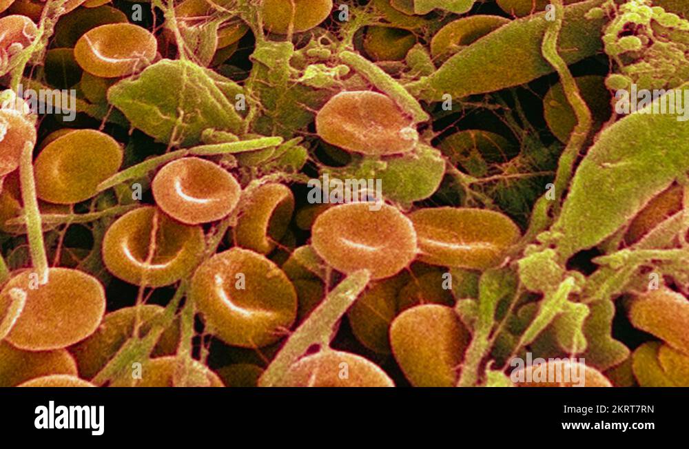 Coagulating process Stock Videos & Footage - HD and 4K Video Clips - Alamy