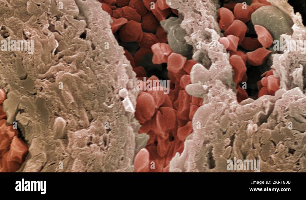 Mucosa of the colon Stock Videos & Footage - HD and 4K Video Clips - Alamy