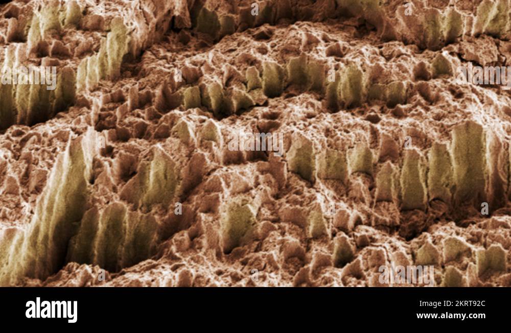 Tooth fracture Stock Videos & Footage - HD and 4K Video Clips - Alamy