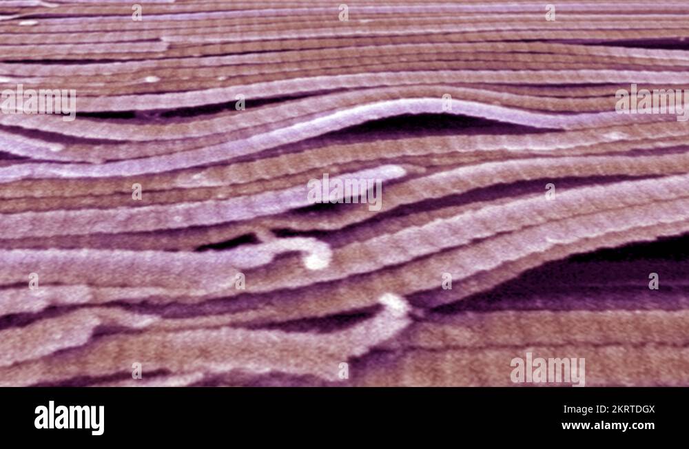 Dense connective tissue collagen Stock Videos & Footage - HD and 4K ...