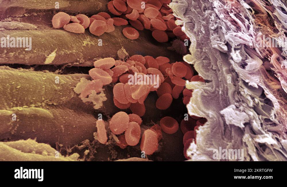 Blood vessel cross section micrograph Stock Videos & Footage - HD and ...