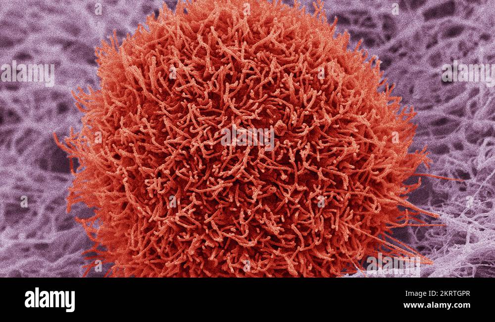Skin cancer cell Stock Videos & Footage - HD and 4K Video Clips - Alamy