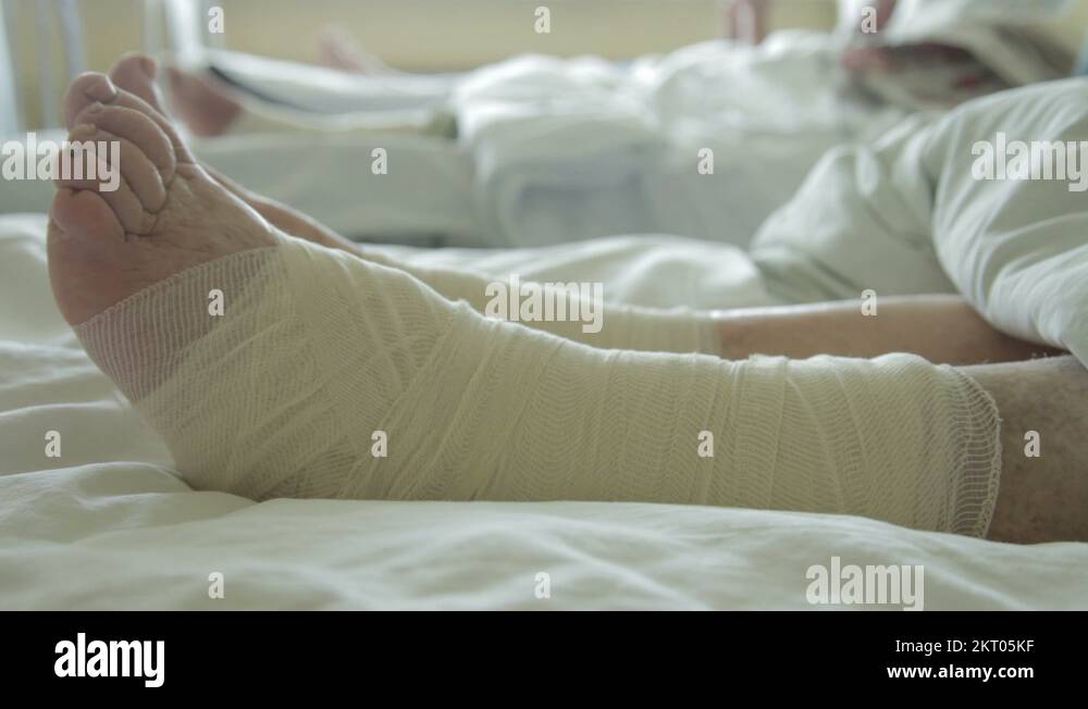 Dermatological diseases Stock Videos & Footage - HD and 4K Video Clips ...