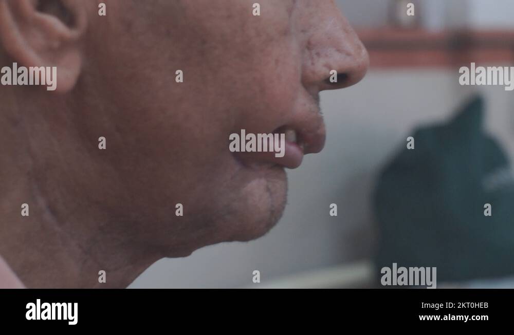 Mouth cancer surgery Stock Videos & Footage - HD and 4K Video Clips - Alamy