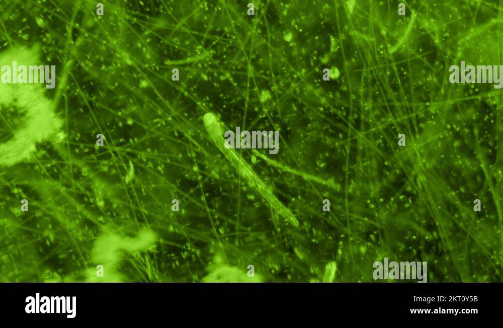 Nematode worm microscope Stock Videos & Footage - HD and 4K Video Clips - Alamy