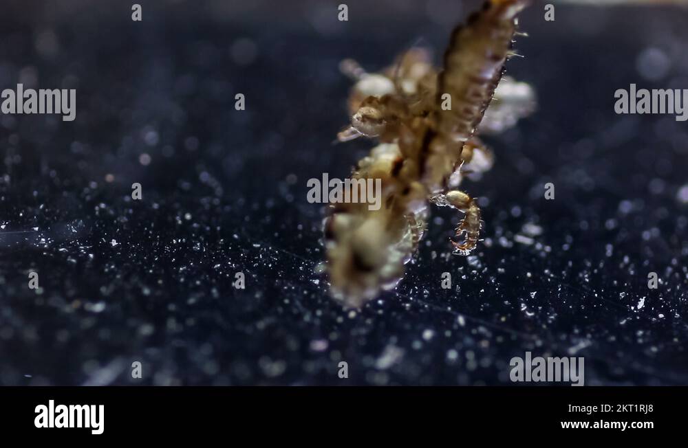 Head lice bite Stock Videos & Footage - HD and 4K Video Clips - Alamy