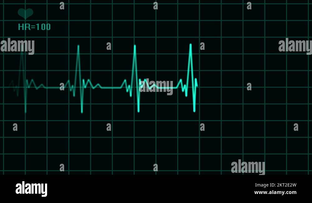 ECG EKG Electrocardiogram Monitor Normal blue Stock Video Footage - Alamy