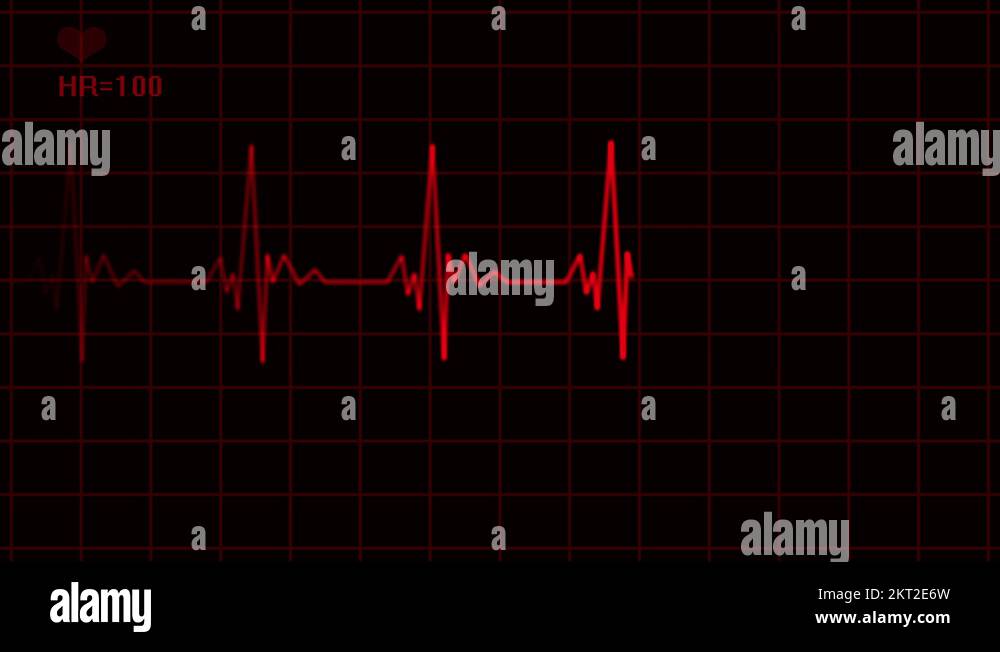ECG EKG Electrocardiogram Monitor Normal Red Stock Video Footage - Alamy